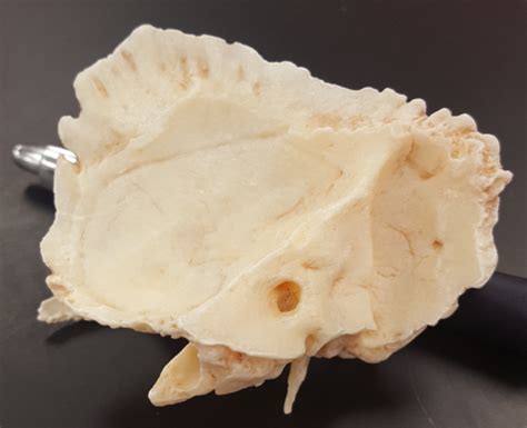 Temporal Bone Interior Diagram Quizlet Temporal Bone Interior Diagram Quizlet