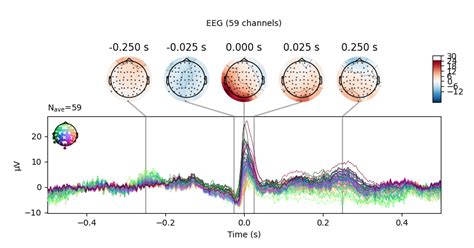 Overview Of Artifact Detection — Mne 1 0 3 Documentation