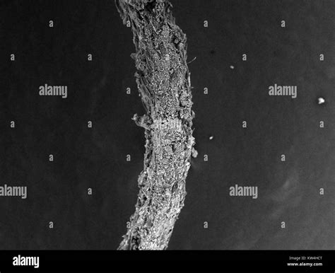 Scanning Electron Microscope Sem Micrograph Of A Plant Root With
