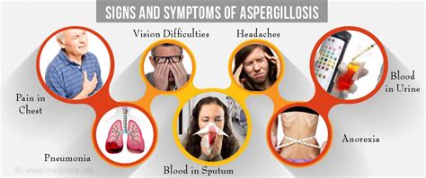 Aspergillosis Types Causes Symptoms Diagnosis Treatment And