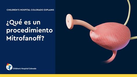 Procedimiento De Mitrofanoff Propósito Proceso Y Recuperación Guía