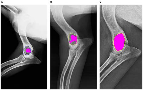 Frontiers Case Report First Evidence Of A Benign Bone Cyst In An