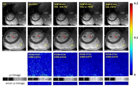 Selfcolearn Self Supervised Collaborative Learning For Accelerating Dynamic Mr Imaging