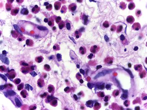 Eosinophils Under The Microscope Observation And Discussion