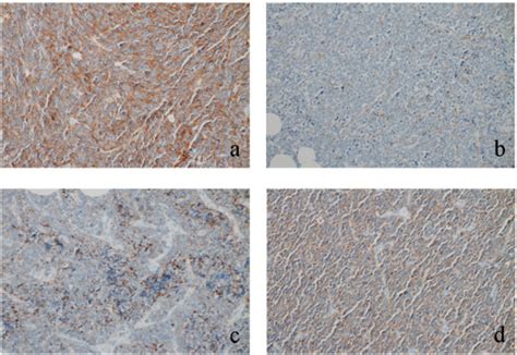 Immunohistochemical Expression For Neuroendocrine Markers In Metastatic Download Scientific