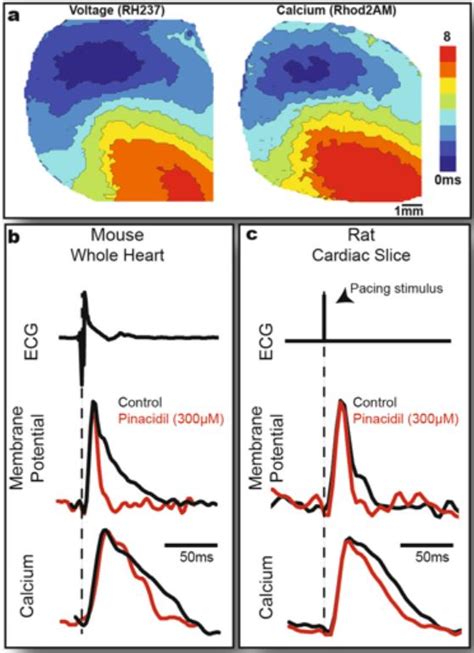 Open Source Solution Could Lower Cost Of Optical Cardiography Bioscan