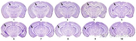 脑海马结构简介 知乎