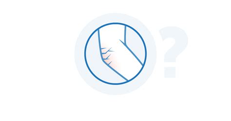 Сухая кожа на локтях причины и меры профилактики