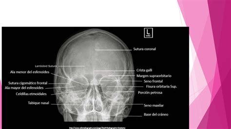 Radiografía De Los Senos Paranasales