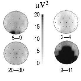 Topographic maps of baseline EEG spectral power μV in patients Download Scientific Diagram