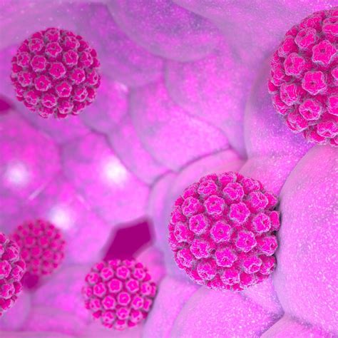 The Hybrid Capture Ii Human Papillomavirus Hpv Dna Test Was Approved By The Fda