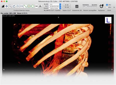 Osirix Opis Programu