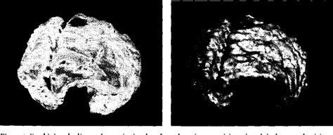 Figure 1 From Surface Mapping Brain Function On 3d Models Semantic