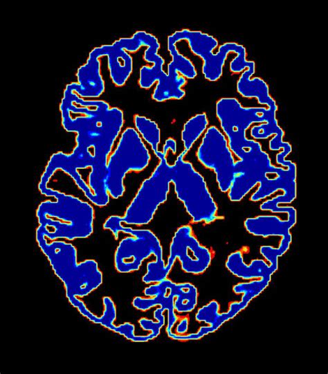 Deep Cnn Ensembles And Suggestive Annotations For Infant Brain Mri Segmentation Deepai