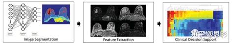 精准医学中的深度学习和影像组学 知乎