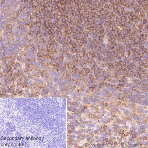 Anti Cbl Antibody [17 C Cbl] Ko Tested Ab309549 Abcam