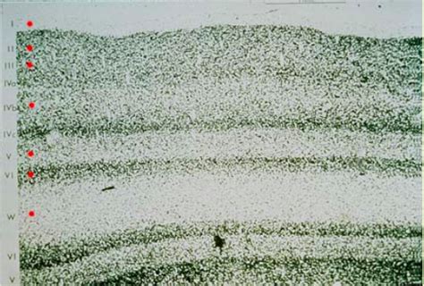 Cerebral Cortex Slide