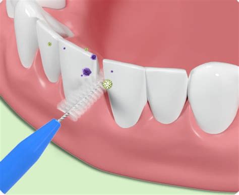 How To Use Interdental Brushes Nagy