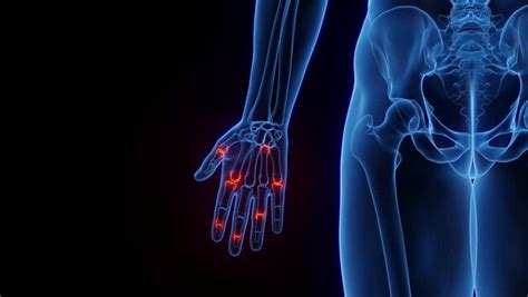 Metacarpals Bilder Durchsuchen 3981 Archivfotos Vektorgrafiken Und