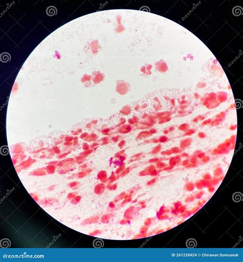 Gram Negative Diplococci