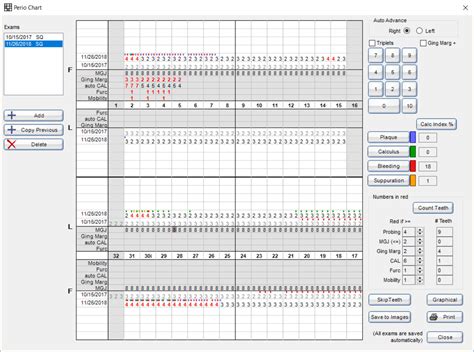 Perio Charting Explained Printable Forms Free Online