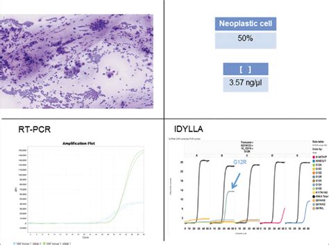 Kras Detection On Archival Cytological Smears By The Novel Fully Automated Polymerase Chain