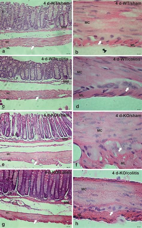 Photomicrographs Showing Hande Stained Sections Of The Myenteric Plexus Download Scientific