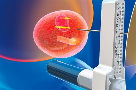 Biopsia De Prostata Urología San Gerónimo Santa Fe Capital