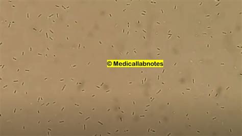 Citrobacter Freundii Introduction Morphology Pathogenicity Lab