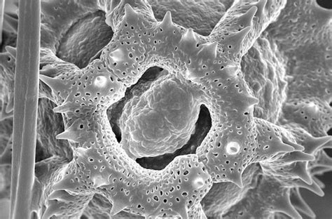 Pollen On A Bee Seen Through A Powerful Microscope 3 Pics