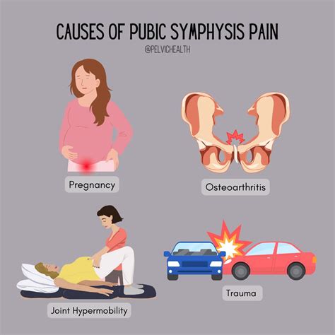 The Pubic Symphysis Is A Fibrocartilaginous Joint Connecting Your Pelvic Bones Stephanie