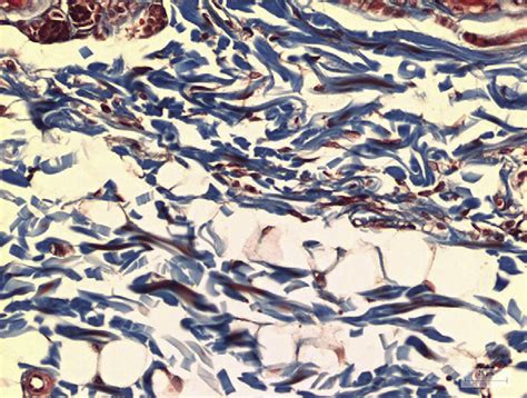 Figure 1 From Skin Fragility Syndrome In A Cat With Cholangiohepatitis And Hepatic Lipidosis