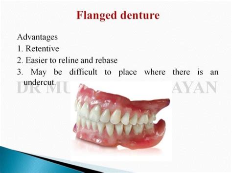 Immediate Denture