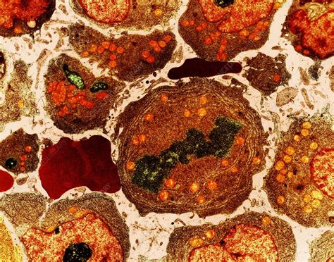 Plasma Cell Cancer Tem Stock Image C0199932 Science Photo Library