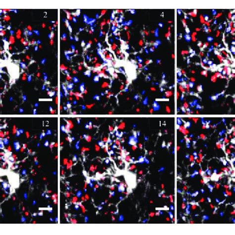 Cortical Two Photon Imaging On Awake Mouse Resting Microglia Are Download Scientific Diagram