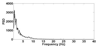 PSD Of Ten Sample EEG Signals From Class F Download Scientific Diagram