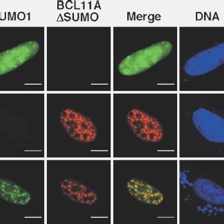 BCL11A Recruits The SUMO1gg But Not The SUMO1aa Mutant Myc BCL11A And