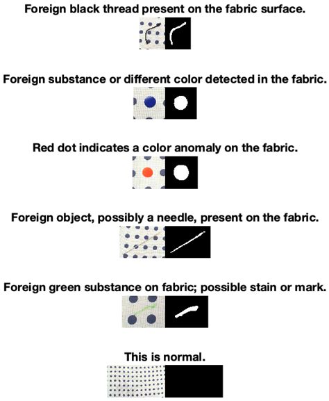 Llm Enhanced Anomaly Classification For Images Artificial