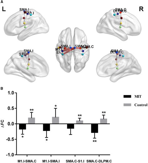 Figure 1 From Motor Imagery Therapy Improved Upper Limb Motor Function