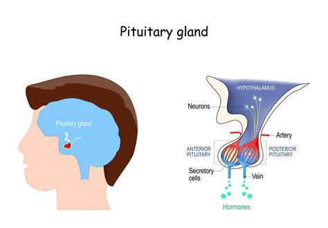 Hypopituitarism Pituitary Gland Disorder Causes And Treatments