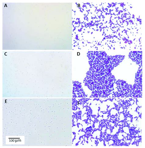Example Microphotographs Of Lactic Acid Bacteria Isolates From Honeybee Download Scientific