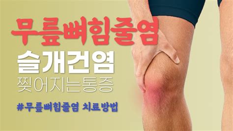 무릎뼈힘줄염 무릎앞쪽통증이 있으시면 고중량스쿼트는 조심하세요 Youtube
