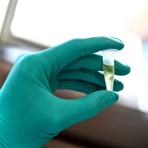 Book Csf Protein And Sugar Test Price In Delhi Ganesh Diagnostic