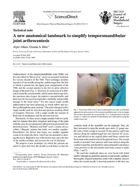 7and2 Tmj Arthrocentesis Pdf