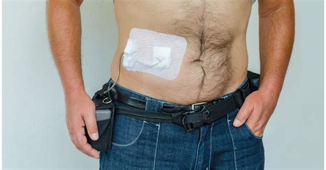 Ventricular Assist Device Purpose Preparation Procedure Aftercare