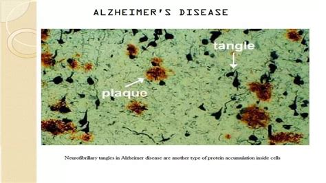 Cell Accumulations Foundation Block Pathology Ppt