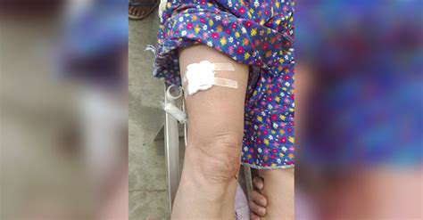 ကလေးတွင် စစ်တပ်လက်နက်ကြီးကြောင့် ဒေသခံ ၁ ဦးသေဆုံး၊ ၄ ဦးဒဏ်ရာရ