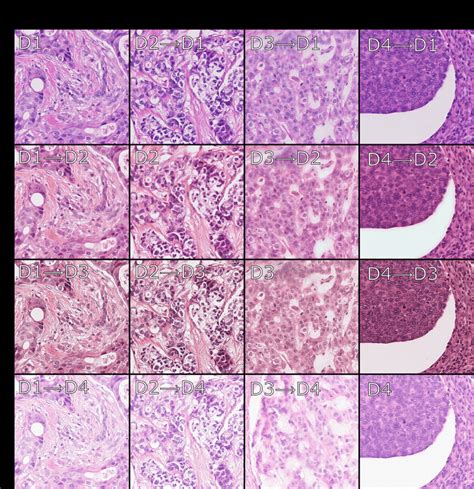 Residual Cycle Gan Transformed Patches The Diagonal Are Original Download Scientific Diagram