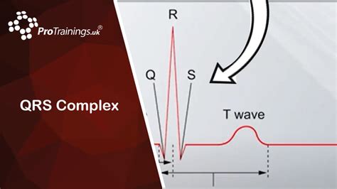 Qrs Complex Ecg Awareness Online Training Video Ecg Awareness Level