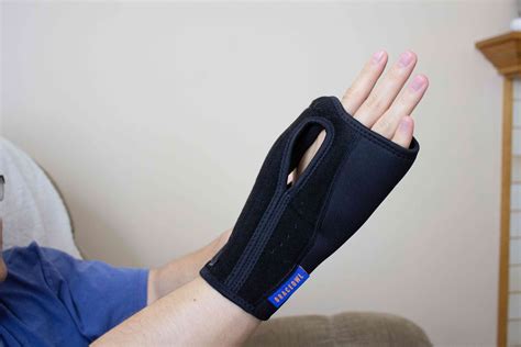 Median Nerve Injury Splint